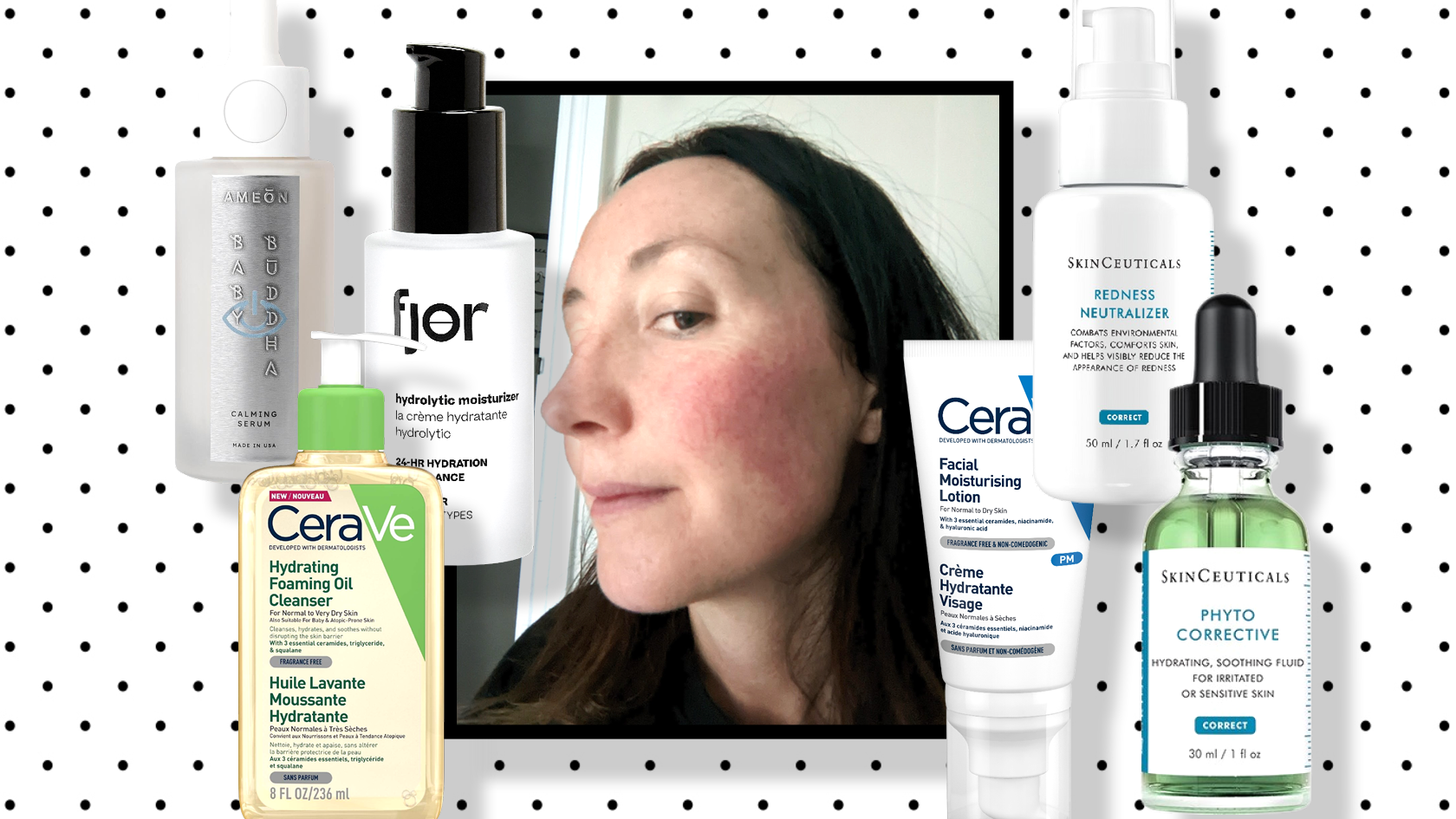 Best cleanser for rosacea store
